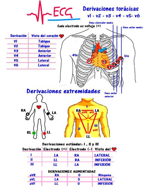 12 Lead Electrocardiogram (EKG) (electrocardiograma de 12 derivaciones (ECG)) | ENALLTerm